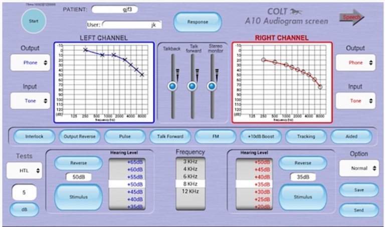 From the Audimeter to the Audiometer | Canadian Audiologist