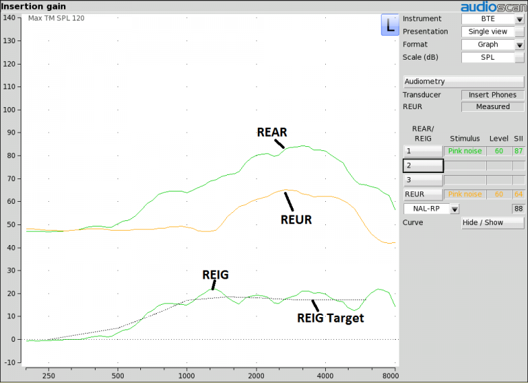 Considerations in Real-Ear Measurement: Points to Ponder | Canadian ...