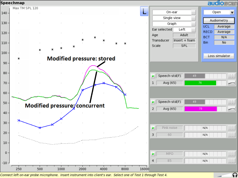 Considerations in Real-Ear Measurement: Points to Ponder | Canadian ...