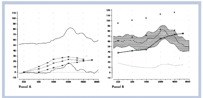 Considerations in Real-Ear Measurement: Points to Ponder | Canadian ...