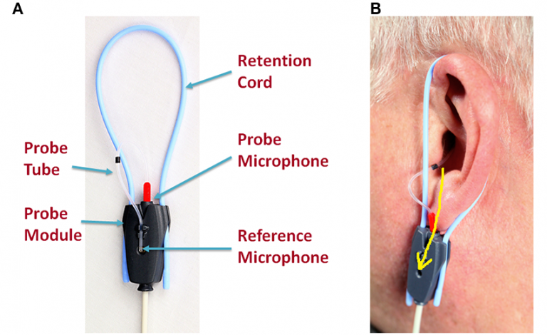 Considerations in Real-Ear Measurement: Points to Ponder | Canadian ...