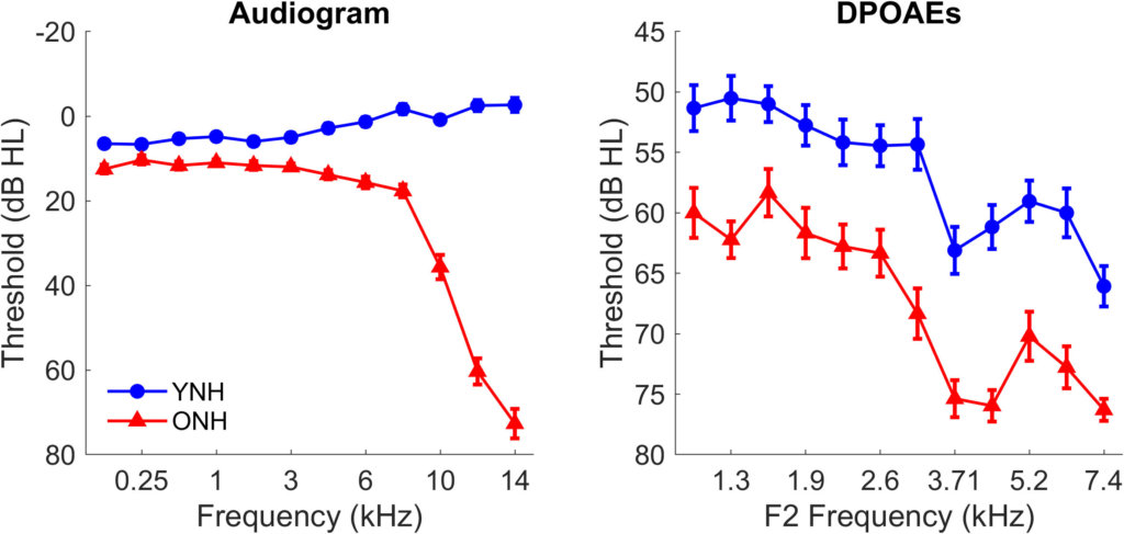 MATLAB Handle Graphics | Canadian Audiologist