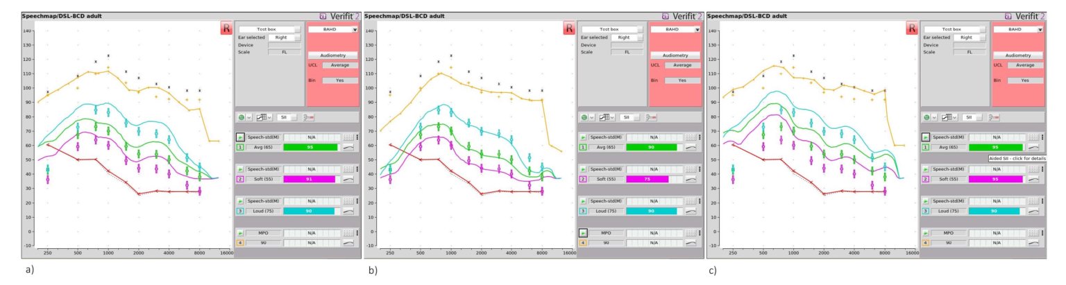 A Case for Reducing Judgement Noise in Our Bone Conduction Fittings ...