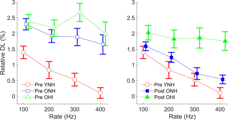 Mysteries of the Hearing Brain: Auditory Training May Partially Restore Temporal Processing ...