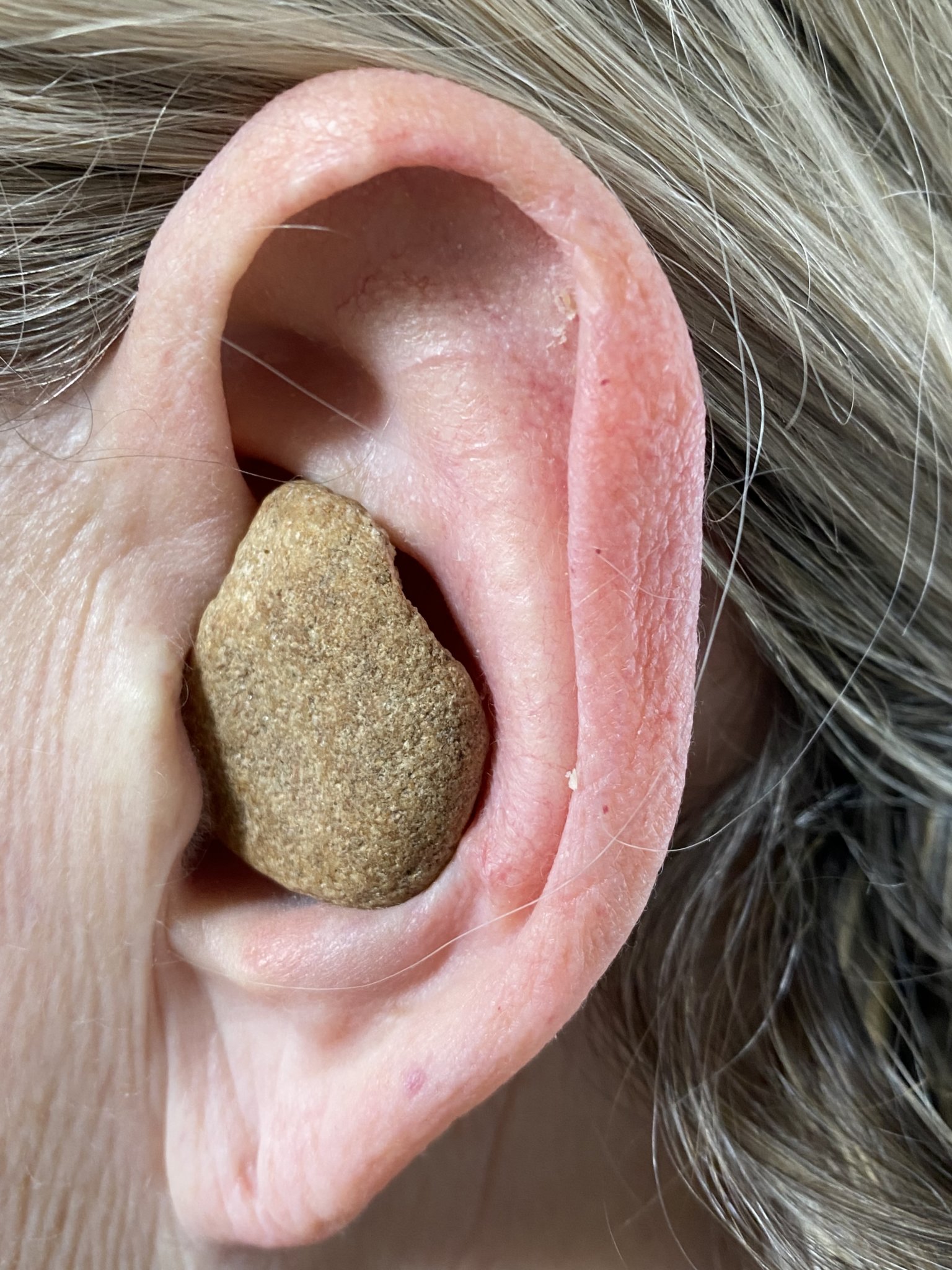 New Discovery- Cavemen wore hearing protection! | Canadian Audiologist