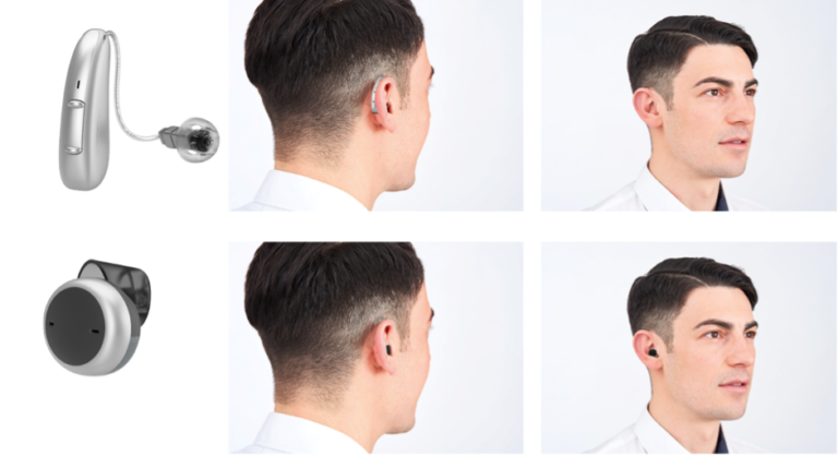 The Appeal of Signia’s Innovative Form Factors and Their Role in the ...